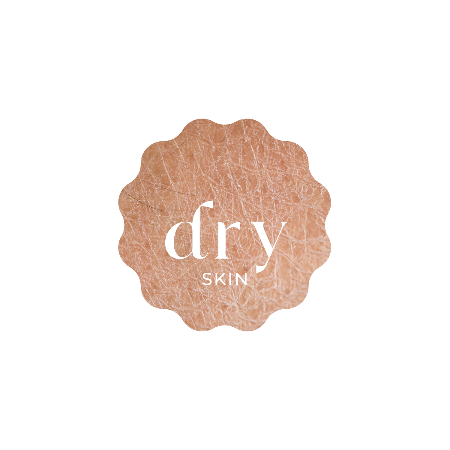Products treatments for dehydration dry itchy skin - Narellan Sydney ...