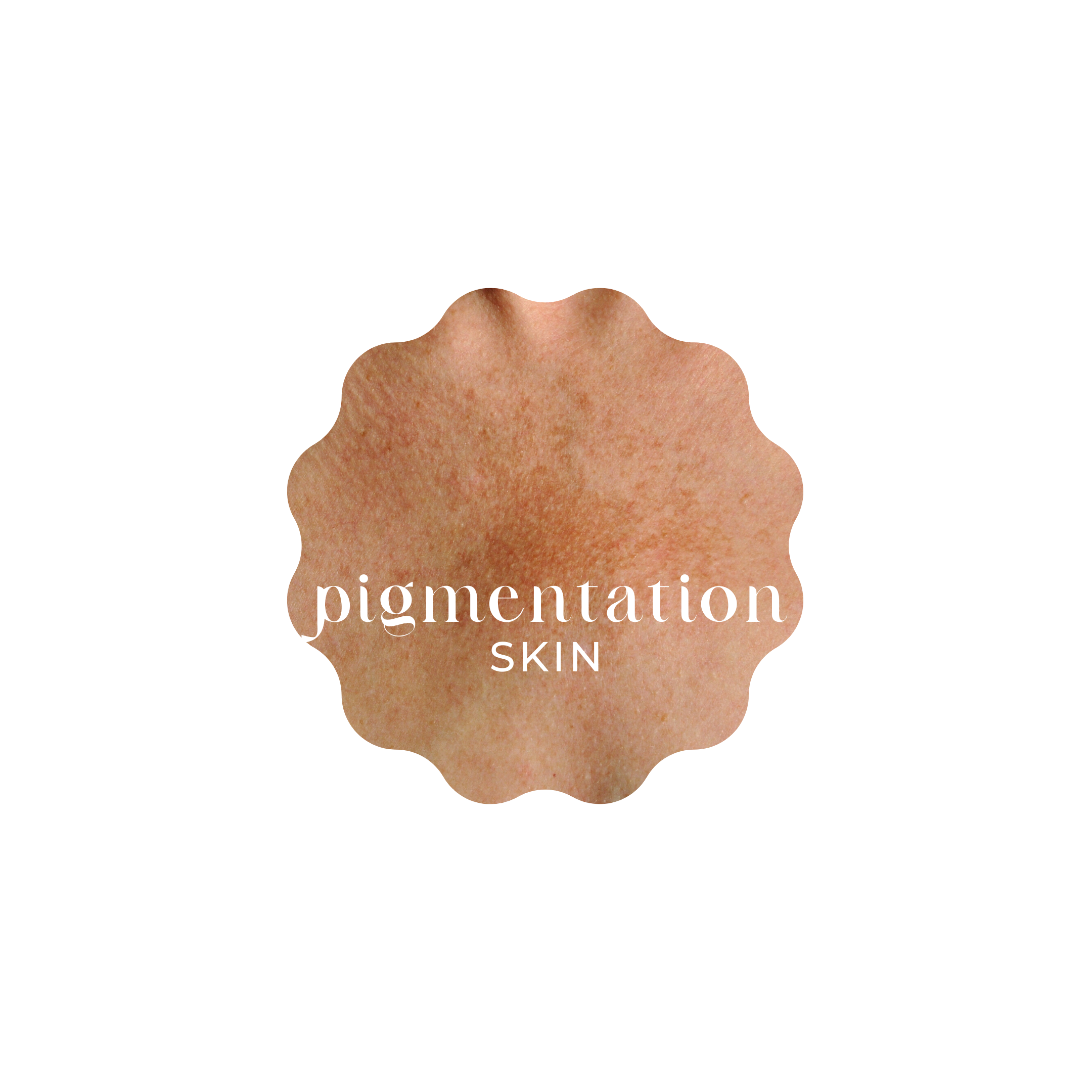 Skincare products treatments for pigmentation, dark spots, uneven ...