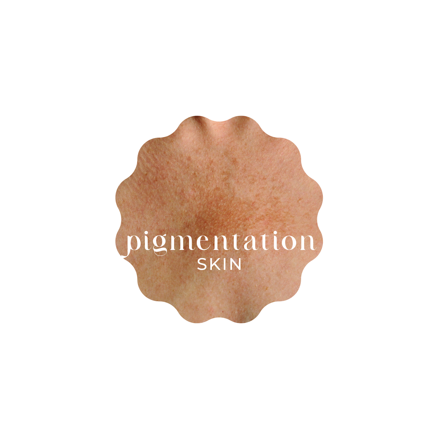 Skincare products treatments for pigmentation, dark spots, uneven ...